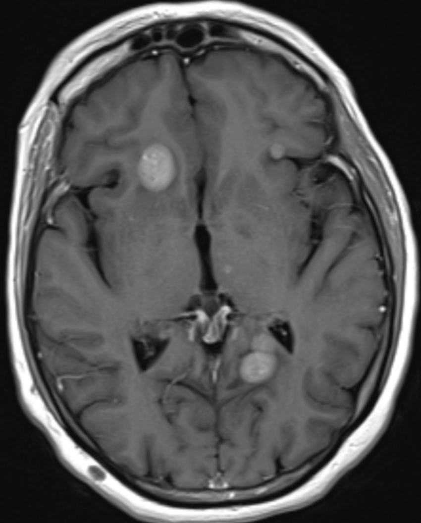 Cancer Diagnosis and Tests – Reno Cancer Center